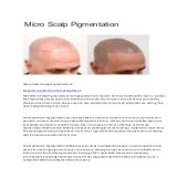 Micro scalp pigmentation | DOCX