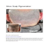 Micro Scalp Pigmentation.docx