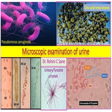 Mucus Threads In Urine Men