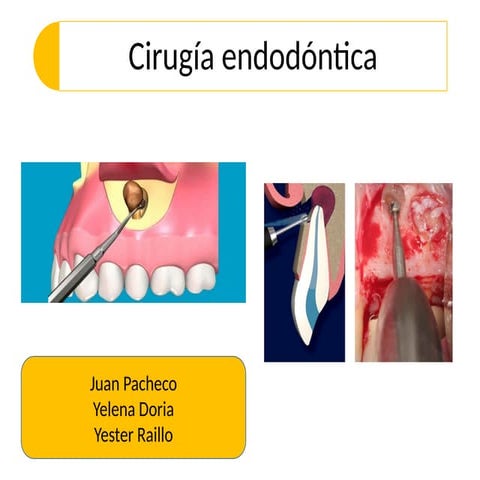 MICROSCOPIO (cirugías apicales o endodonticas) | PPTX