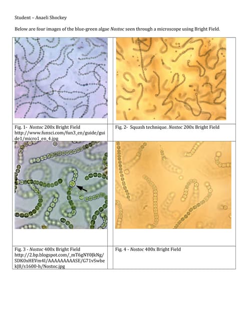 Nostoc Microscope