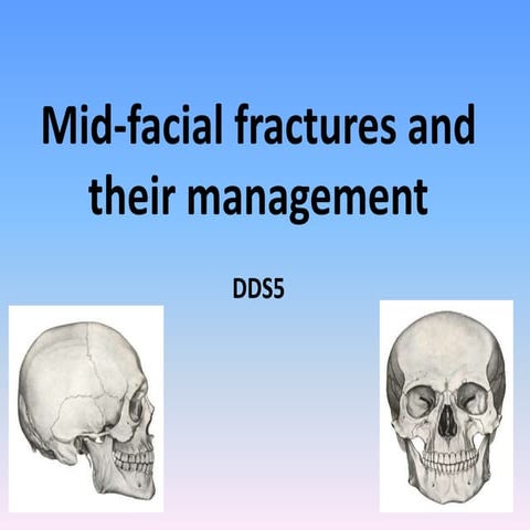 Mid facial fractures and their management | PPTX