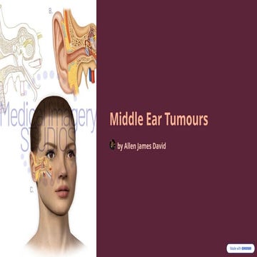Middle-Ear-Tumours by Allen James David .pptx