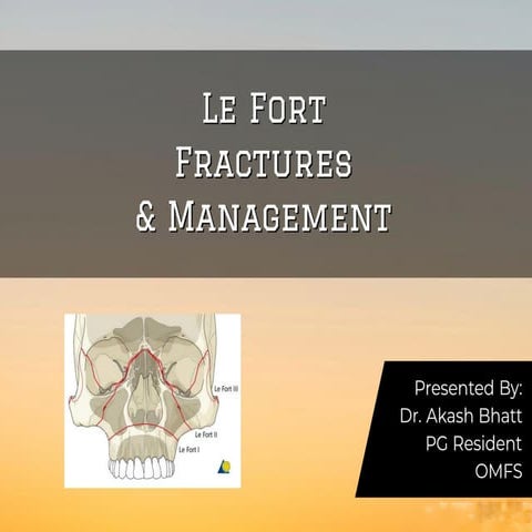 Lefort Fracture Iv