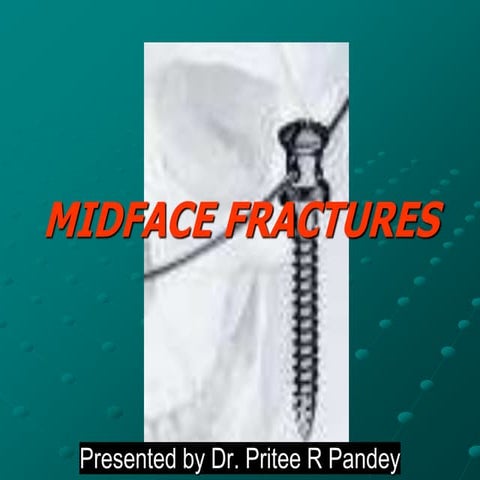 Midface Fracture Part-1.ppt