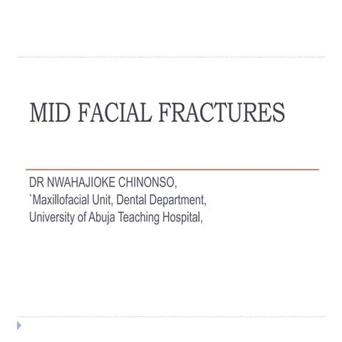Mid facial fractures | PPTX