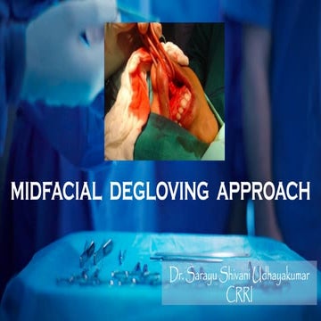 MIDFACIAL_DEGLOVING-SarayuShivani_U.pptx