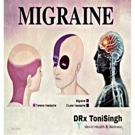 Migraine | PDF