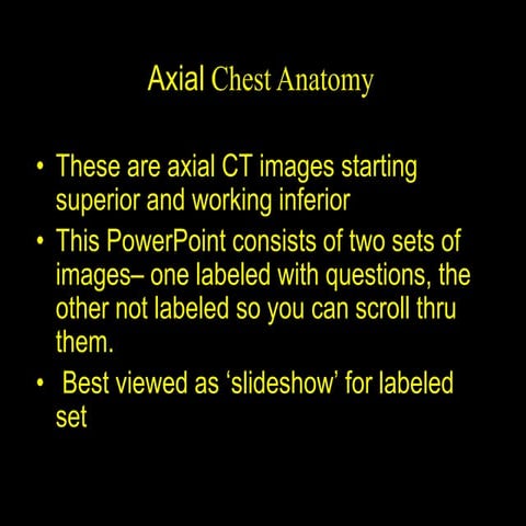 Mike's CT Chest tests, ct scan education | PPT