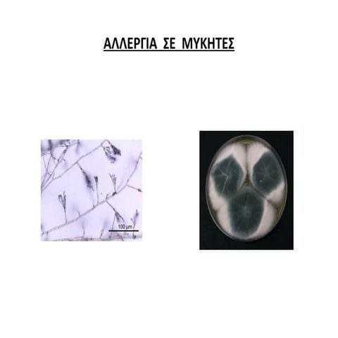 Mikites 54 55 | PPT