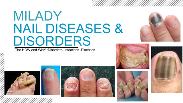 Pedicure contra-actions and aftercare | PPT
