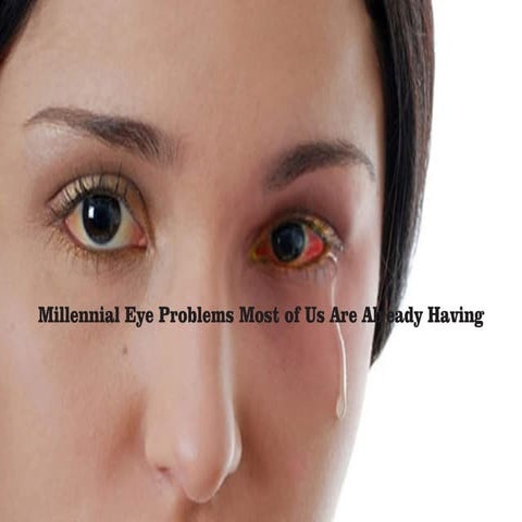 Millennial eye problems most of us are already having | PDF