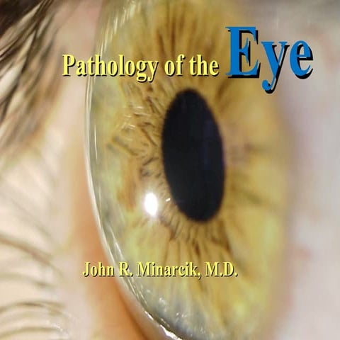 Minarcik robbins 2013_ch29-eye | PPT