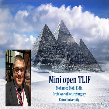 Mini Open Tlif Ppt