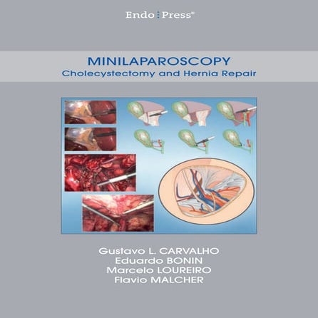 Minilaparoscopy cholecystectomy and hernia repair | PDF