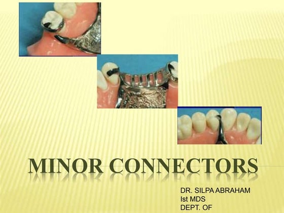 Border Moulding in Complete Denture Prosthesis | PPT