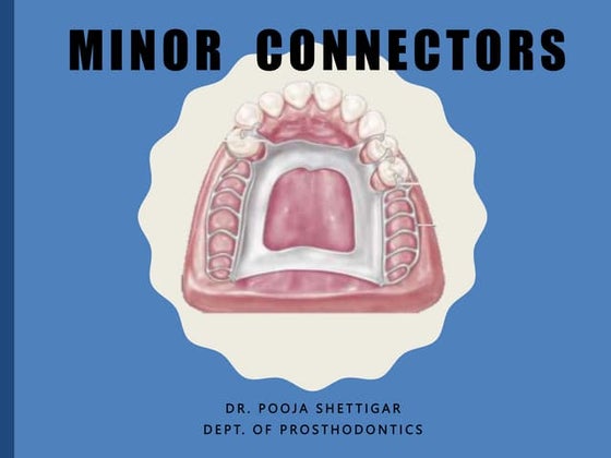 Parts of Cast Partial Dentures | PDF | Oral care | Personal Care