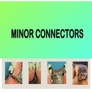 minor connectors .pptx REMOVABLE PROSTHODONTICS | PPTX