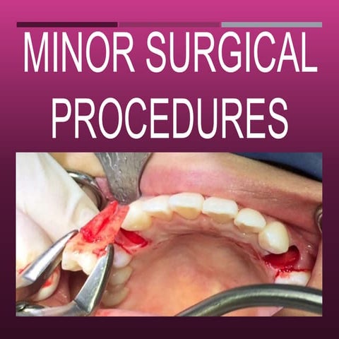 Minor surgical procedures in Orthodontics | PPTX
