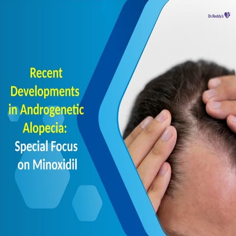 End Feel -joint end feel - Normal and Abnormal end feel | PDF