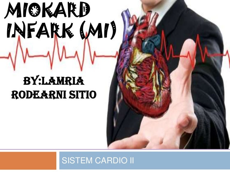 Miokard infark