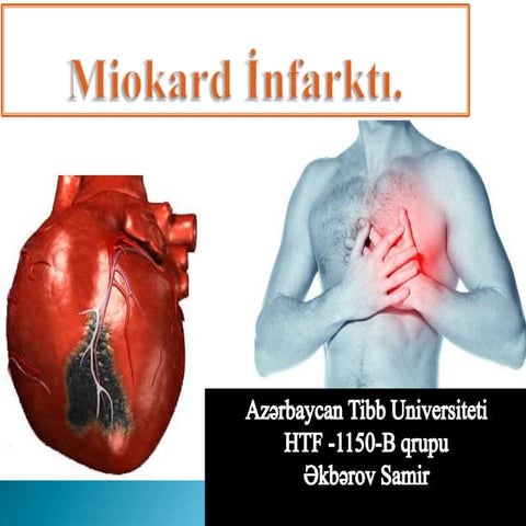 Miokard infarkti (Myocardia infarctus) | PPTX