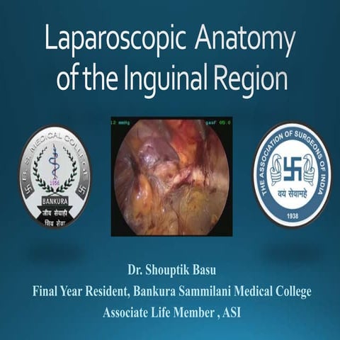 Laparoscopic Anatomy of the Inguinal Region | PPTX