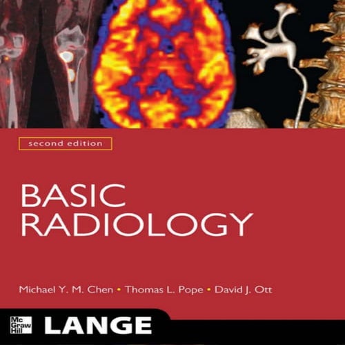 Basic radiology, 2nd ed. | PDF