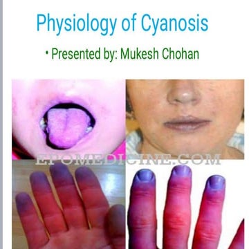Physiology of cyanosis presentation.pptx