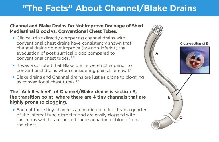 ClearFlow: "The Facts" About Channel / Blake Drains