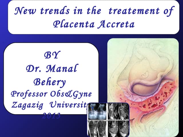PLACENTA ACCRETA | PPTX