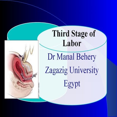Normal labour, third stage by Dr Yin Moe | PPT