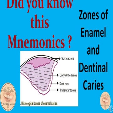 Zones of enamel and dentinal caries completed | PPTX