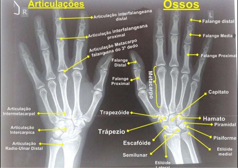 Mão - Anatomia Radiológica