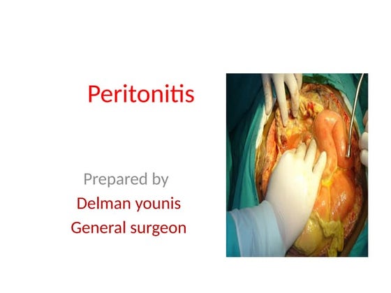 APPROACH TO A PATIENT WITH PERITONITIS.pptx