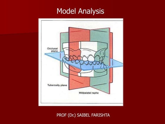 Bolton analysis and mixed dentition analysis | PPTX