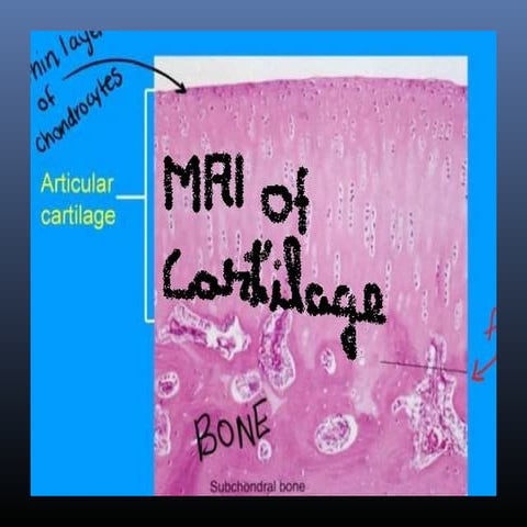 Cartilage imaging simplified | PPT