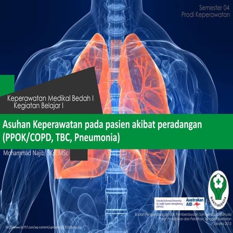 REFRAAT TENTANG TUBERCULOSIS PARU SEQUELE | PDF