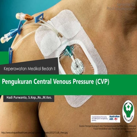 Modul 1 kb3 pengukuran central venous pressure (cvp) | PPTX