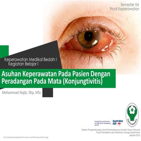 Asuhan Keperawatan Pada Pasien Dengan Peradangan Pada Mata ...