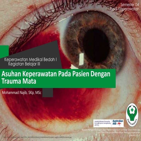 Asuhan Keperawatan Pada Pasien Dengan Trauma Mata | PPTX