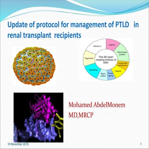Management of PTLD | PDF