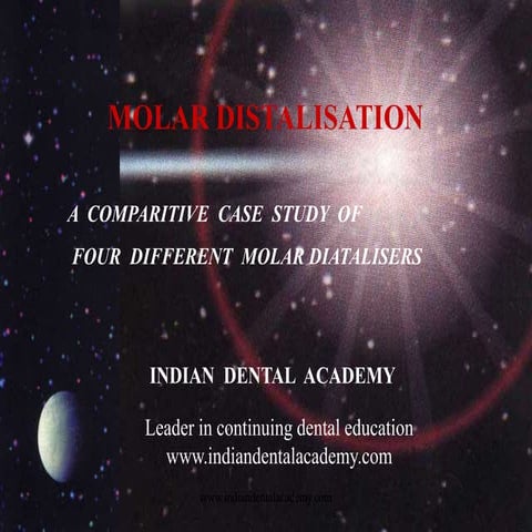 Molar distalisation/fixed orthodontic courses by indian dental academy ...