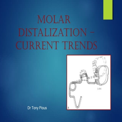 Molar distalisation | PPT