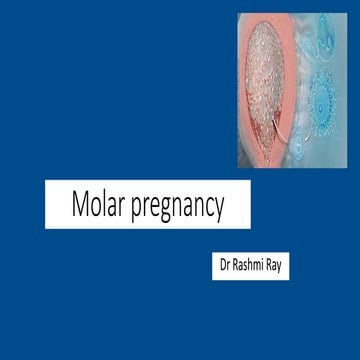 molar for class.pptx
