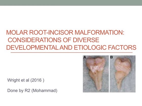 Dentinogenesis Imperfecta dental anomaly | PPT