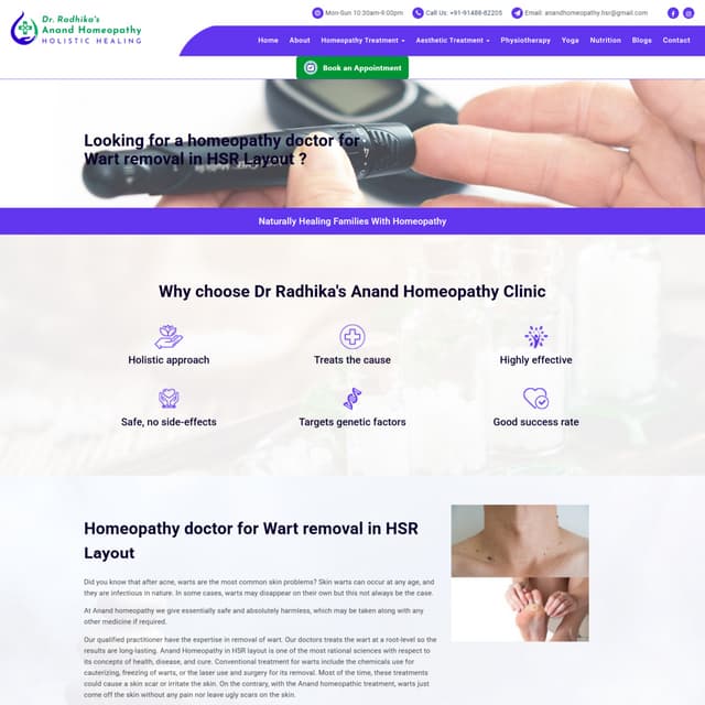 Mole and Wart Removal Foot Corns Treatment in HSR Layout | PDF