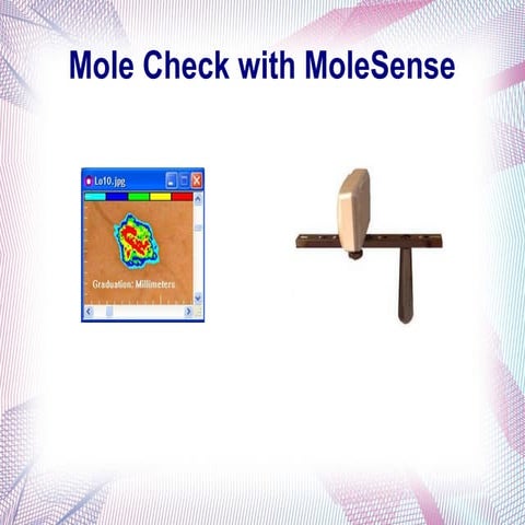 Mole Check with MoleSense | ODP
