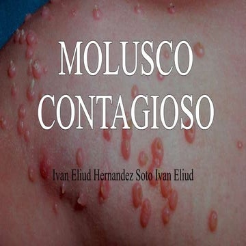 Molusco contagioso | PPTX