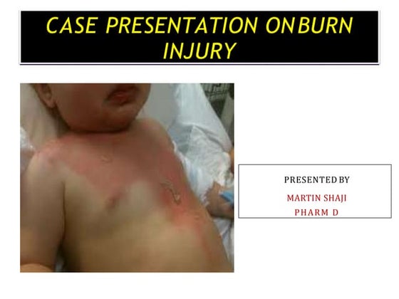 CASE STUDY ON BURNS | PPT